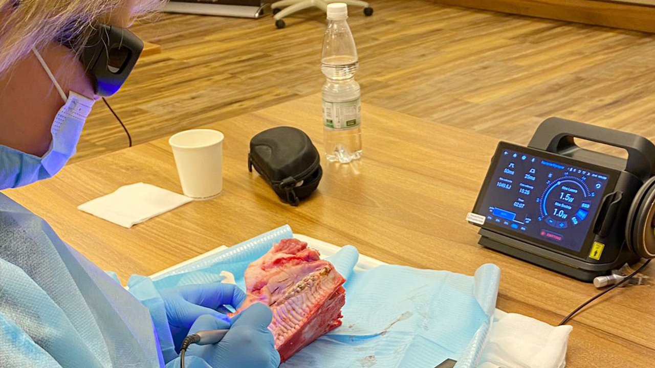 How Is The Pioon Diode Laser Done For Dentistry How Is The Pioon Diode Laser Done For Dentistry